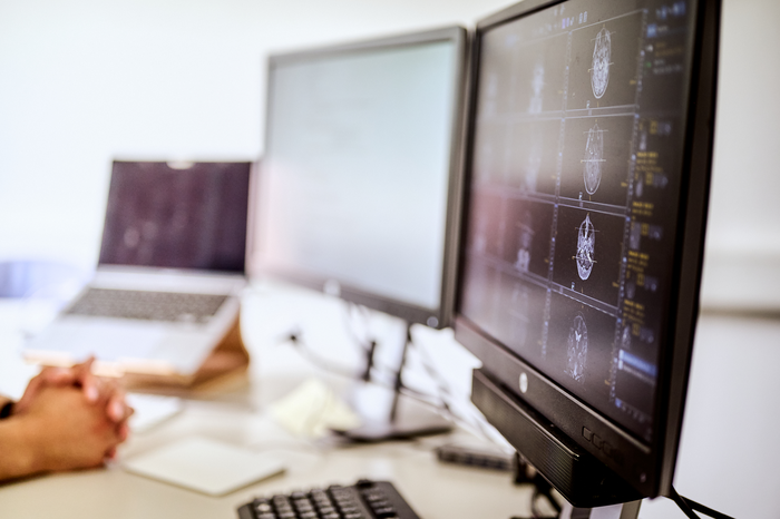 Efficient AI technology for MRI data analysis - BIOENGINEER.ORG