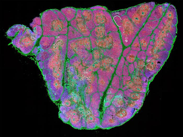 Researchers identify stem cells in the thymus for the first ...