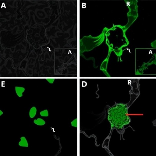 PAI-1 Deficiency Shields Aging Female Mice from Muscle and Bone ...