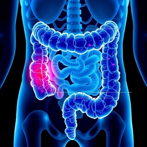 Sodium Butyrate Slows Colon Cancer Cell Growth - BIOENGINEER.ORG