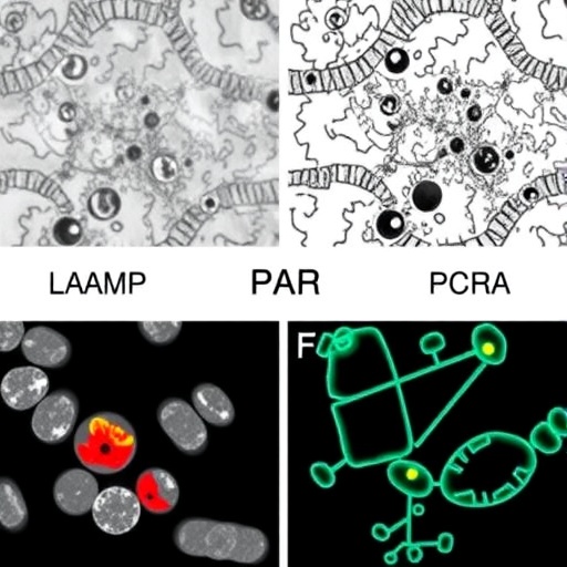Comparing Microscopy, LAMP, PCR for Detecting Bovine Babesiosis ...