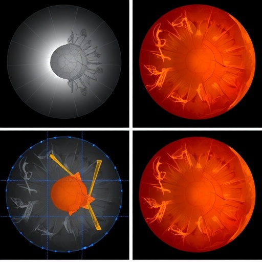 Optimized U-Net Model for Retinal Disc Segmentation - BIOENGINEER.ORG