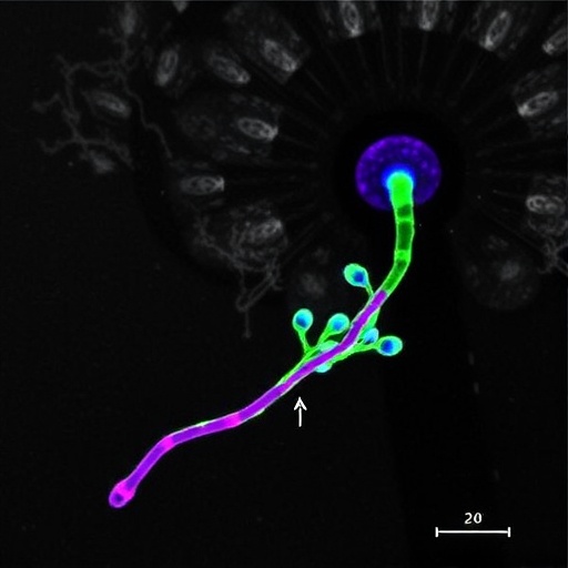 Amyloid-β Impairs Glymphatic Flow via Astrocyte Cholesterol